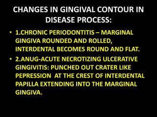 Clinical reatures of gingivitis | PPTX