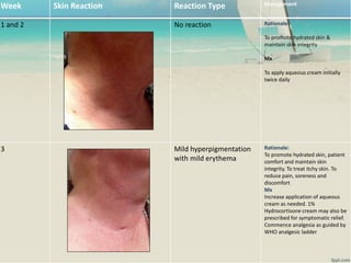 Clinical response of skin and mucosa to radiation | PPTX