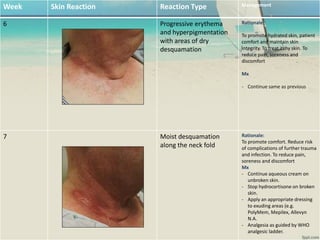 Clinical response of skin and mucosa to radiation | PPTX