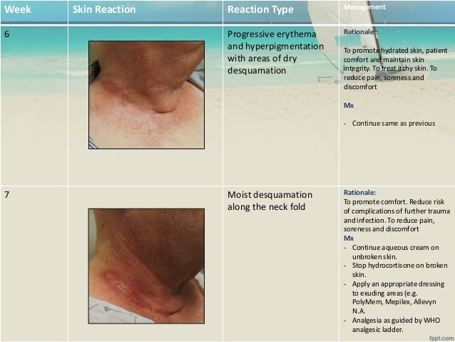 Clinical response of skin and mucosa to radiation