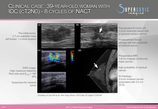 ShearWave™ Elastography in Breast Cancer Patient Management: Clinical ...