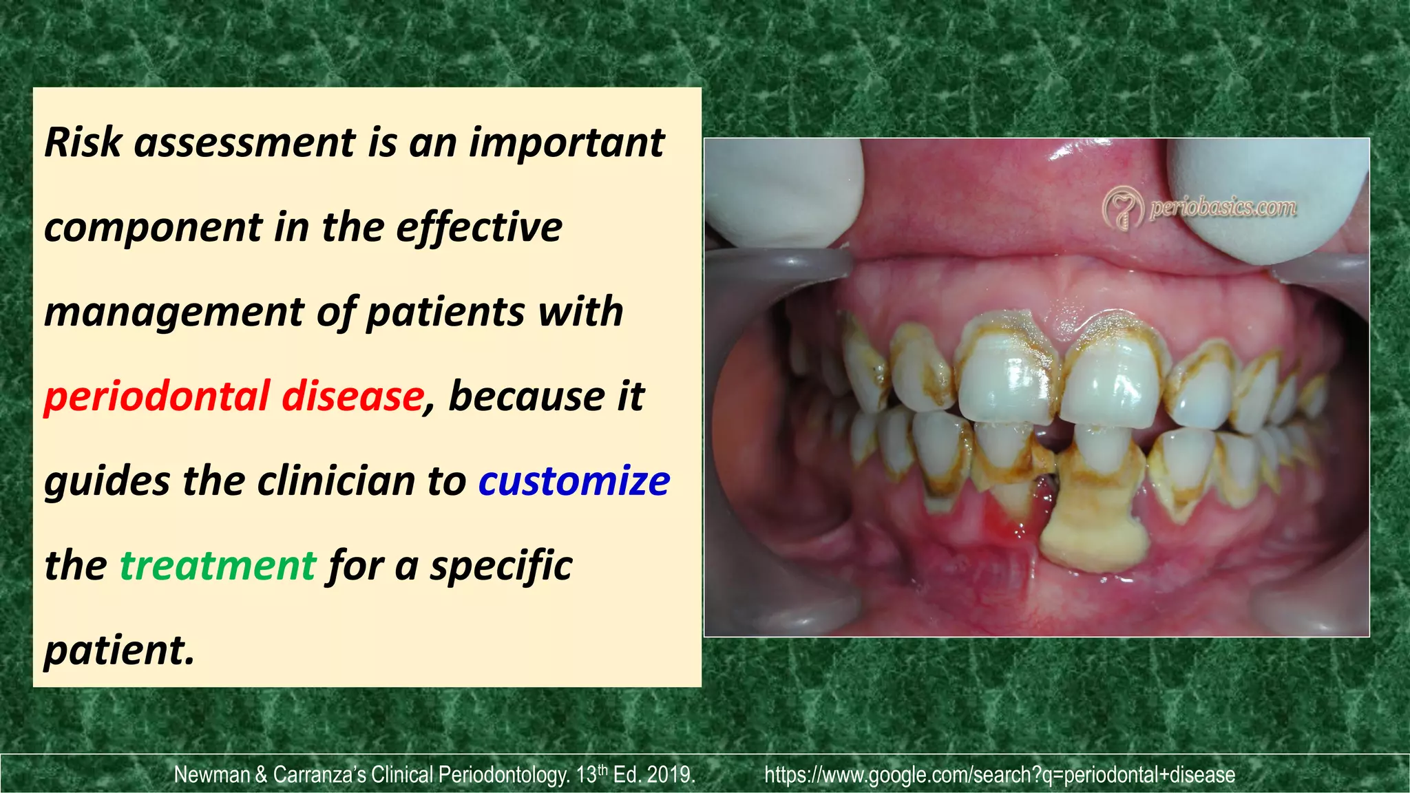 Clinical risk assessment & diagnosis of periodontal disease | PDF