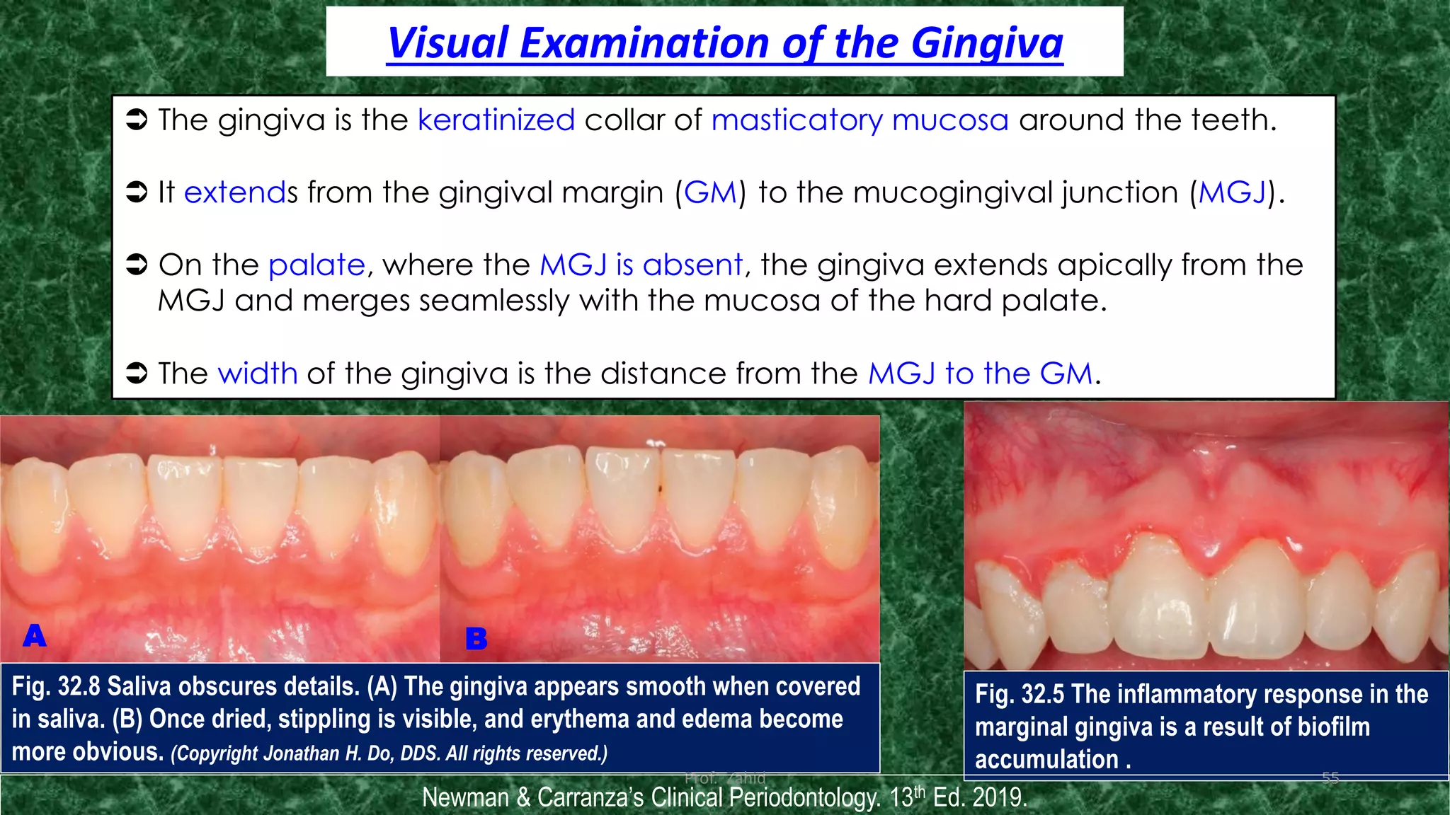 Clinical risk assessment & diagnosis of periodontal disease | PDF