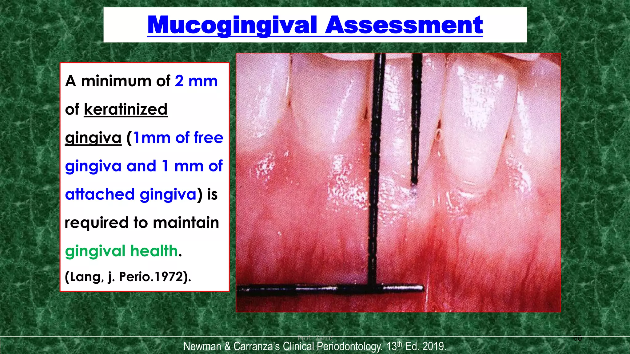 Clinical risk assessment & diagnosis of periodontal disease | PDF