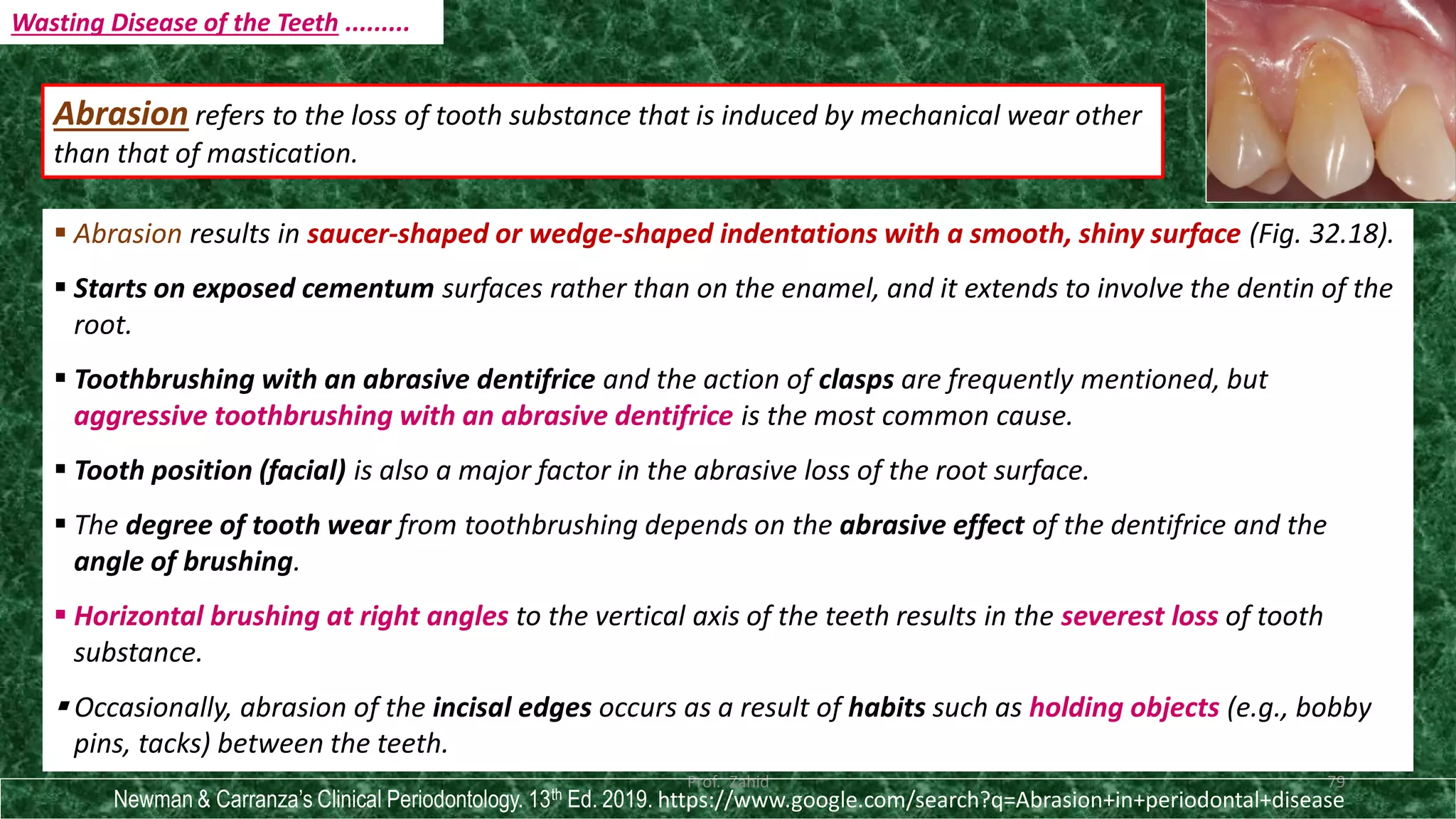 Clinical risk assessment & diagnosis of periodontal disease | PDF