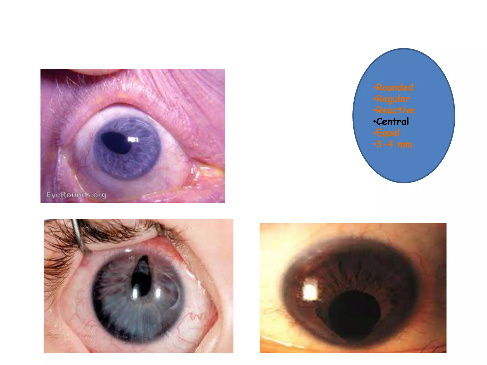 Clinical round ophthalmic revision | PPTX