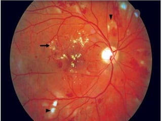 Clinical round test | PPT
