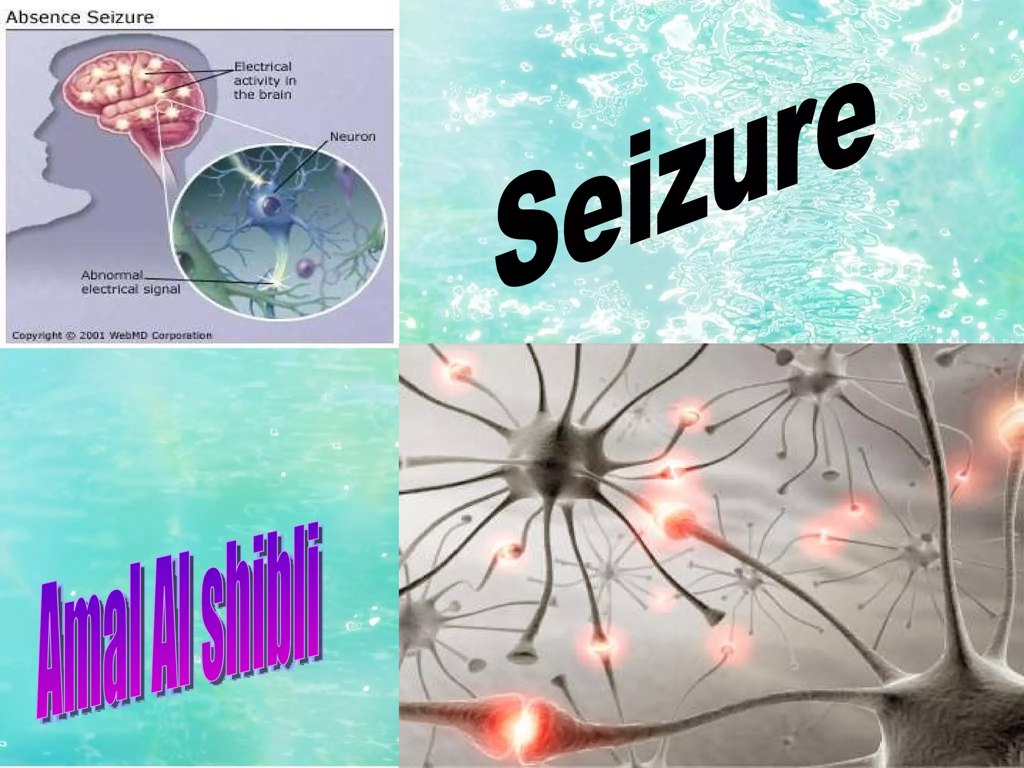 Clinical series.seizure | PPT