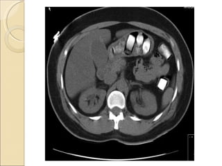 Coccain and Sympathomimatic | PPT