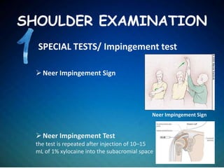 Clinical shoulder examination-osce | PPTX