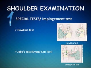Clinical shoulder examination-osce | PPTX | Death, Injury, or Military ...
