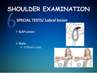Clinical shoulder examination-osce | PPTX