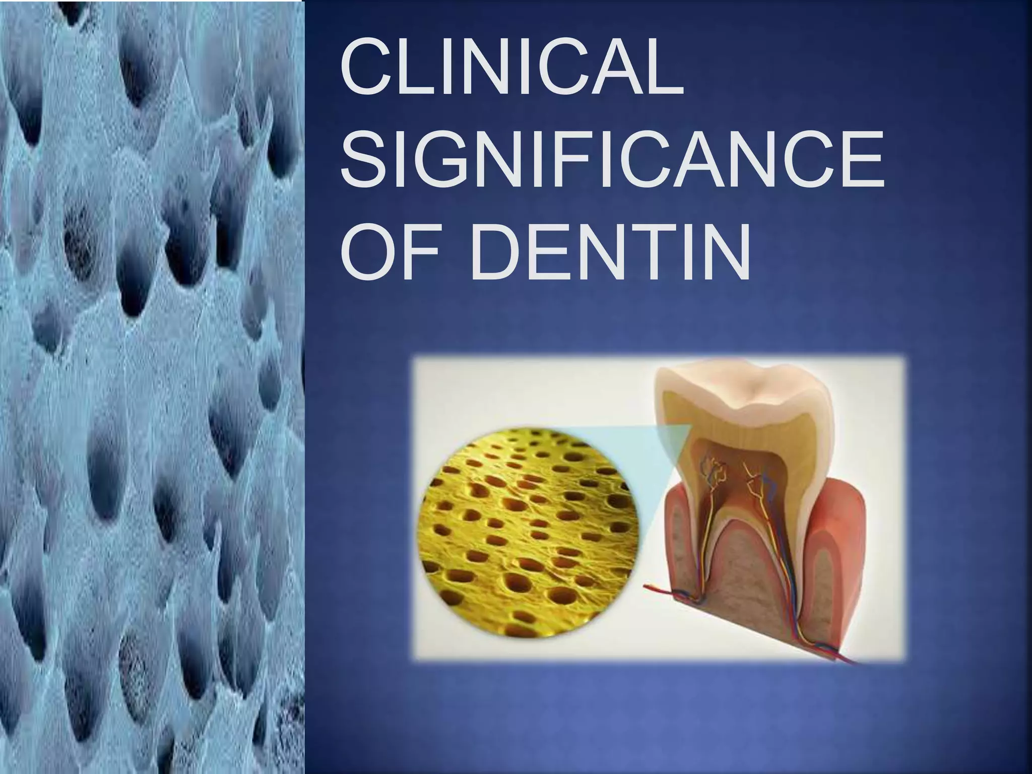 CLINICAL SIGNIFICANCE OF DENTIN.pptx