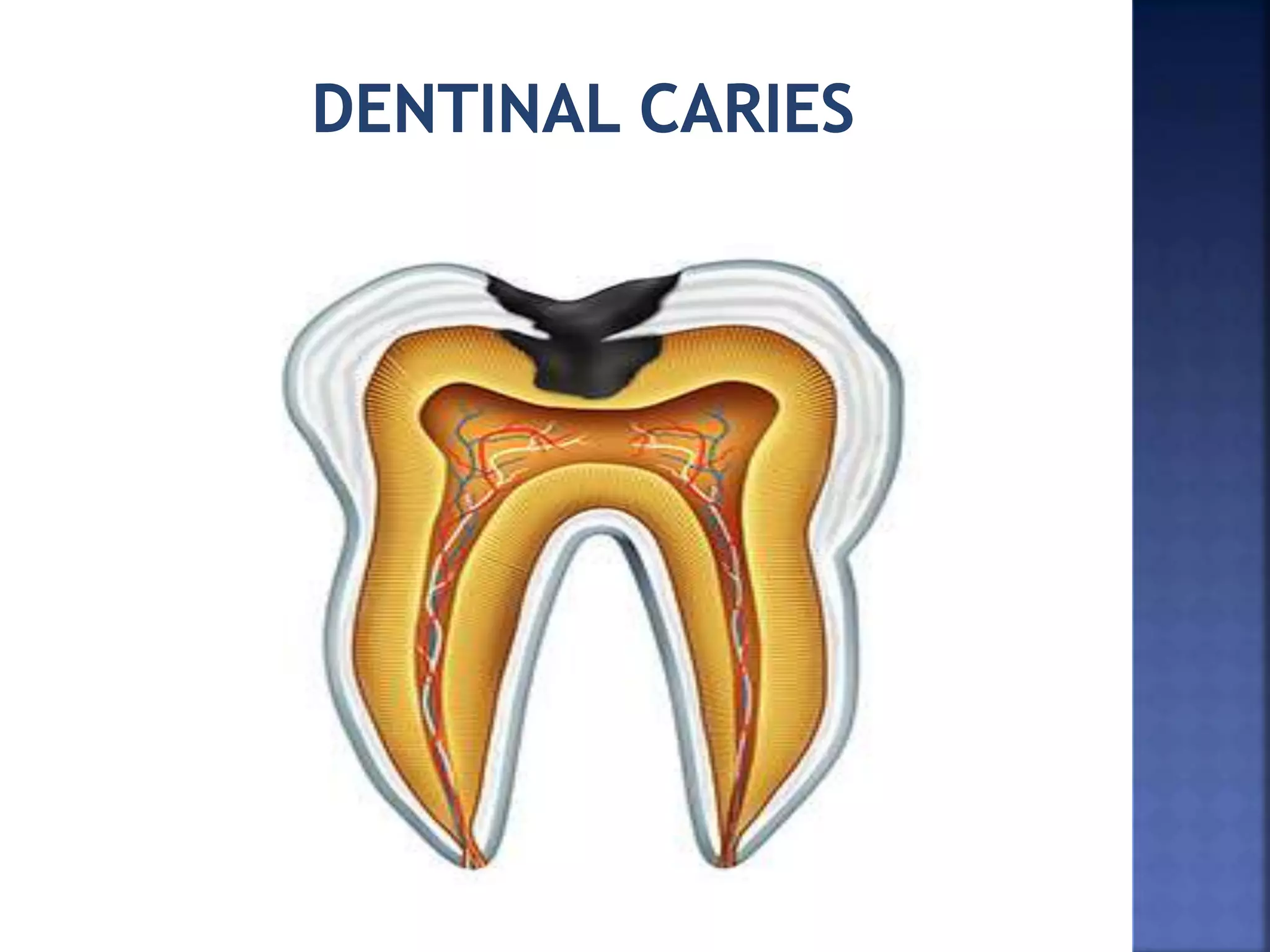 CLINICAL SIGNIFICANCE OF DENTIN.pptx