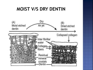 CLINICAL SIGNIFICANCE OF DENTIN.pptx