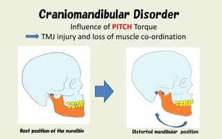 Clinical significance of first phase treatment for tmd final | PDF