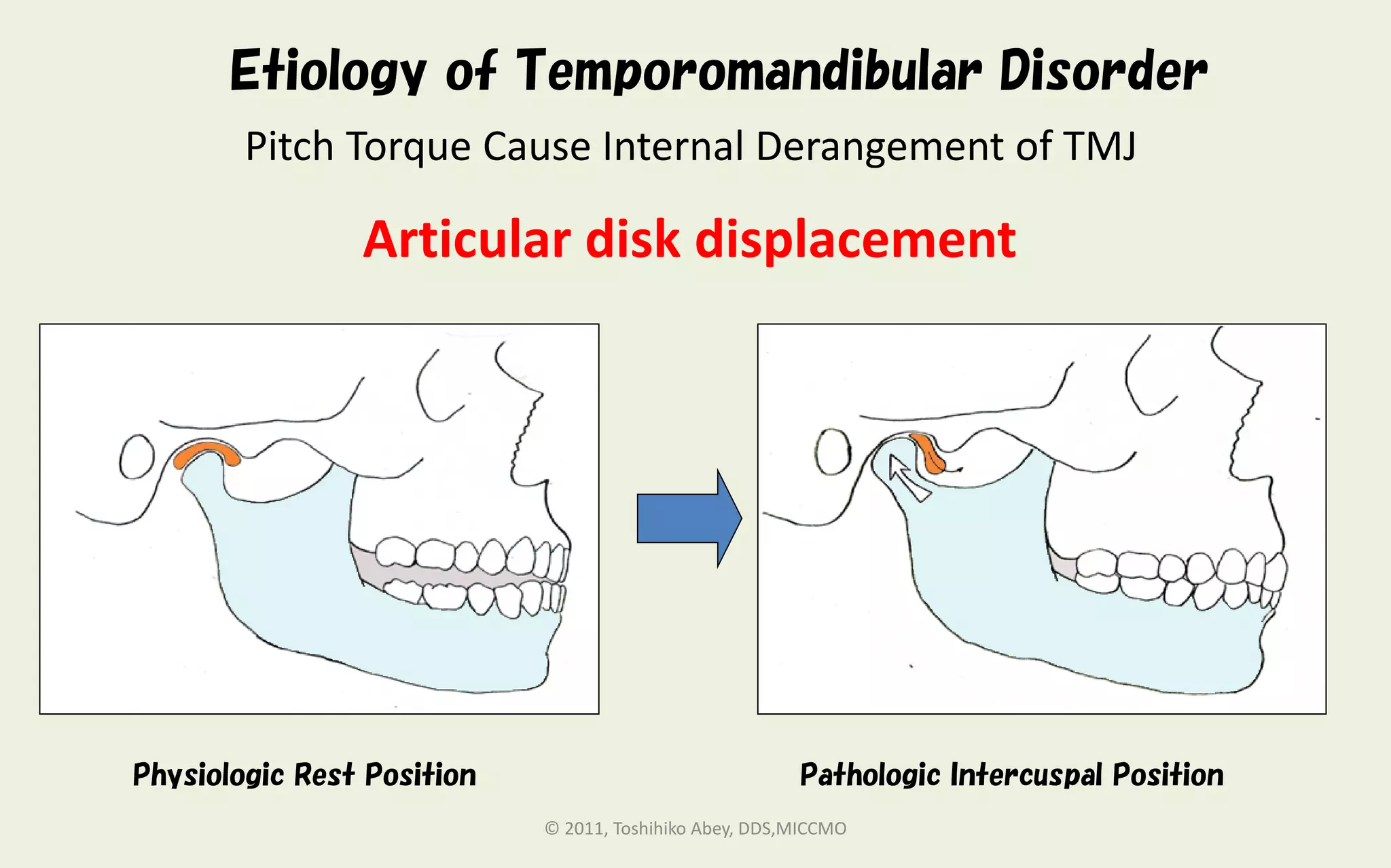 Clinical significance of first phase treatment for tmd final | PPT
