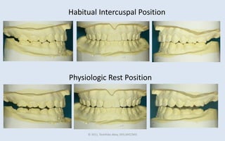 Clinical significance of first phase treatment for tmd final | PPT