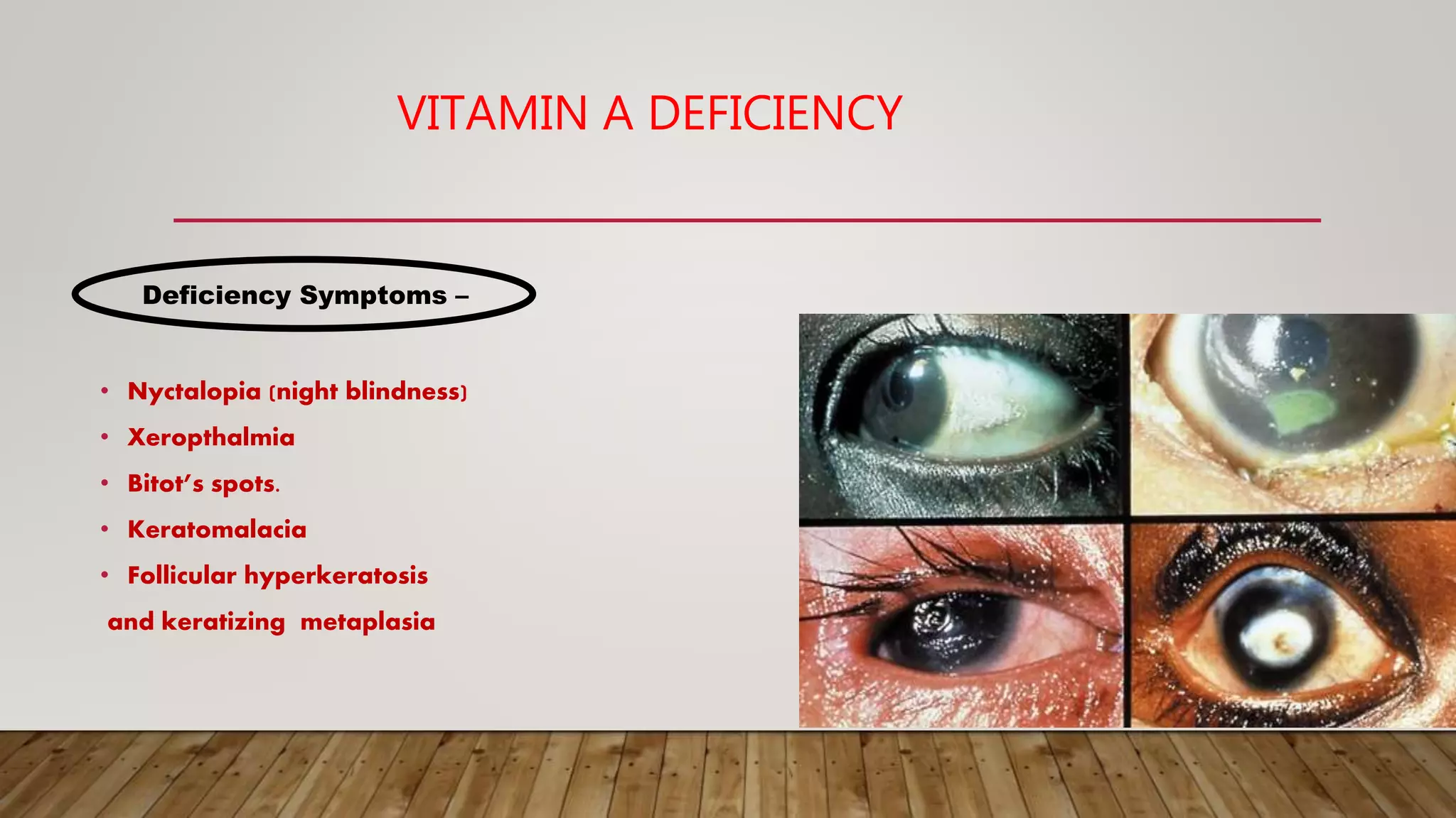 Clinical significance of vitamins | PPTX