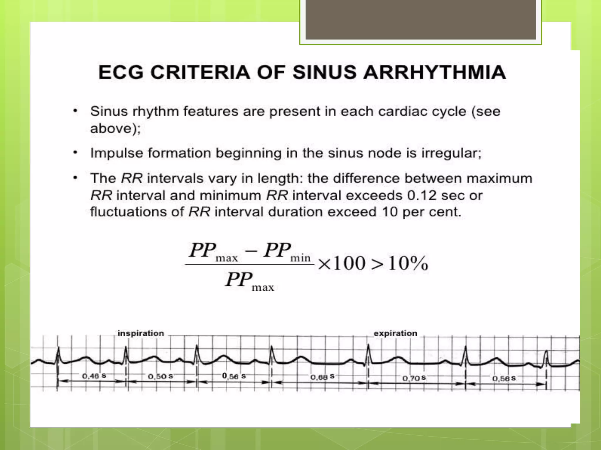 Clinical signs of arrythmia | PPT