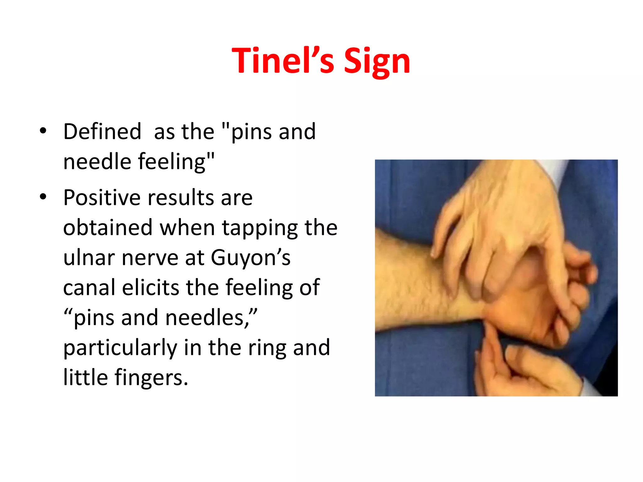 Clinical signs of upper limb | PPTX