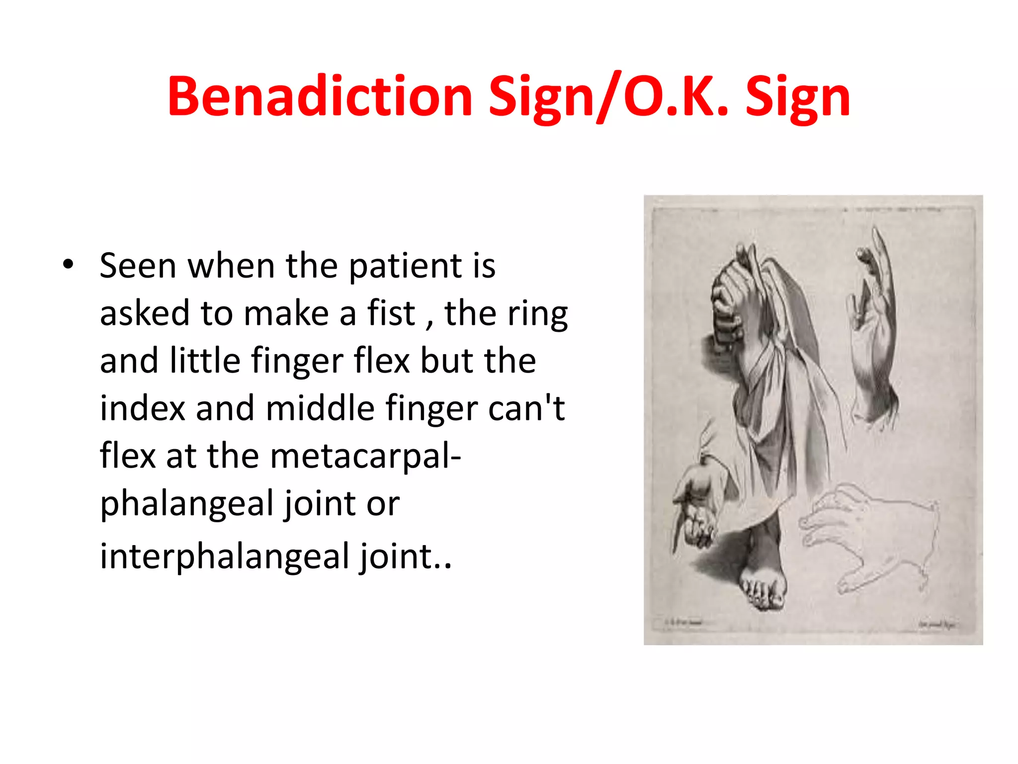 Clinical signs of upper limb | PPTX