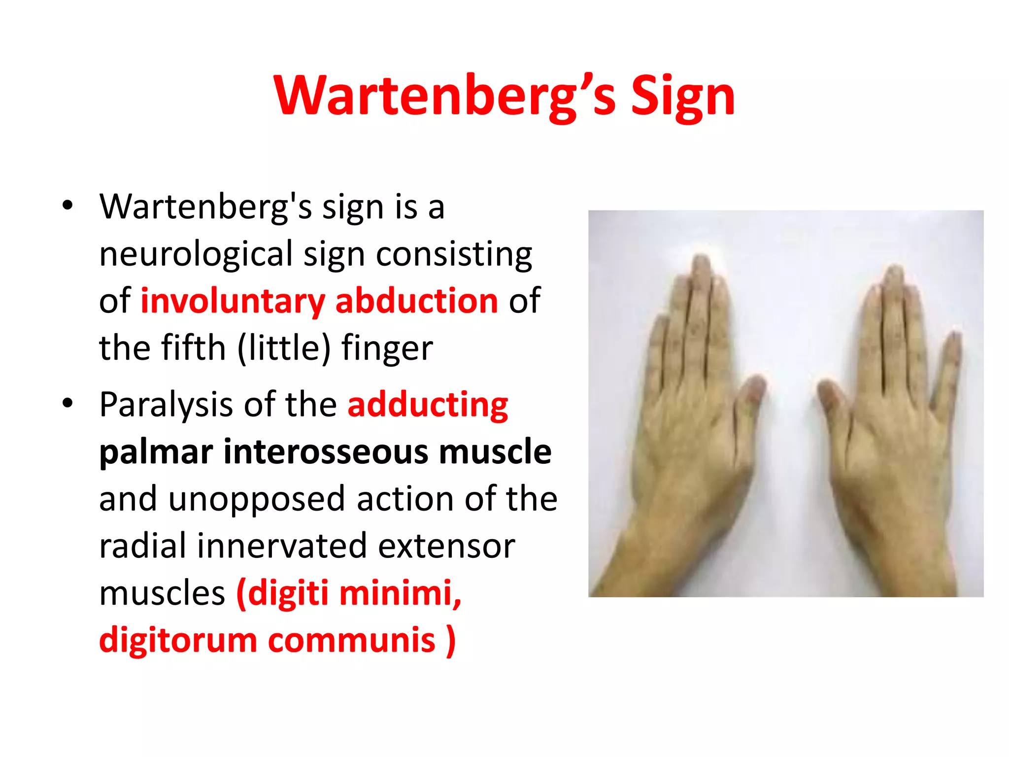 Clinical signs of upper limb | PPTX