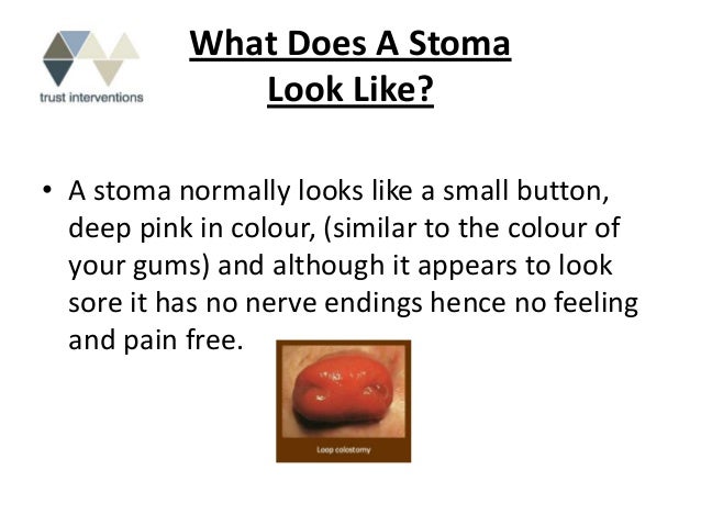 Clinical skills workshop stoma care v1