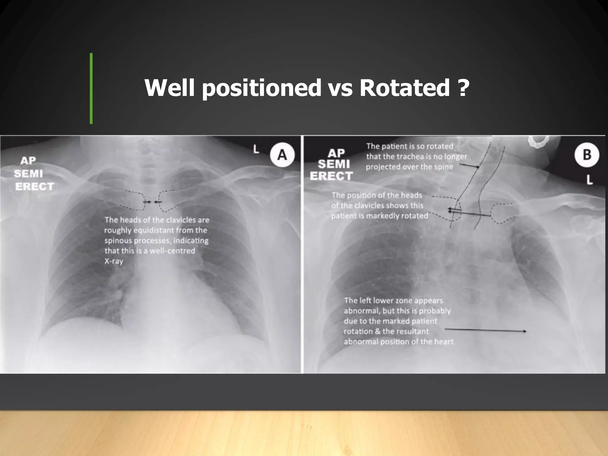 CXR and abdominal film interpretation for medical student | PDF
