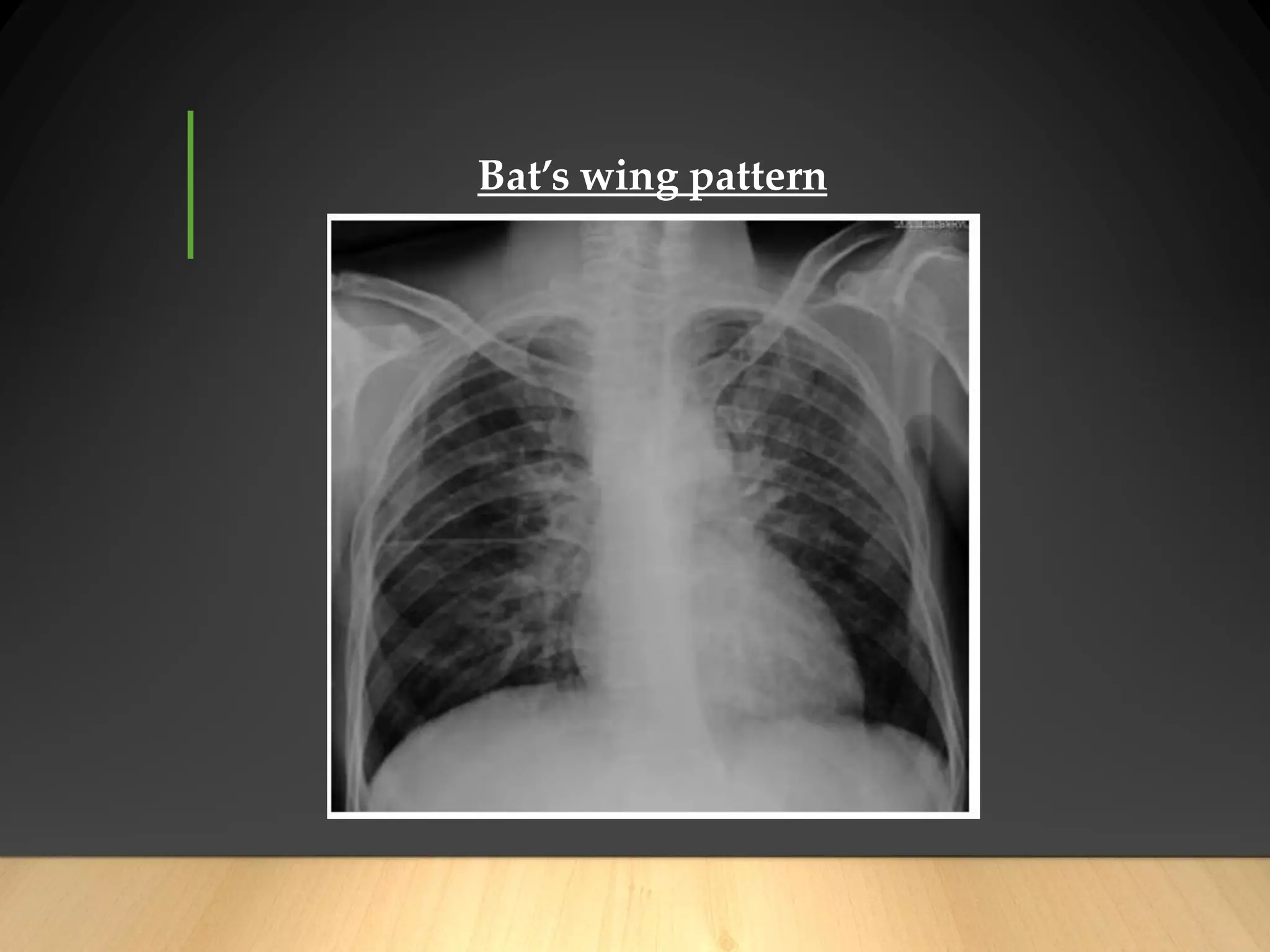 CXR and abdominal film interpretation for medical student | PDF