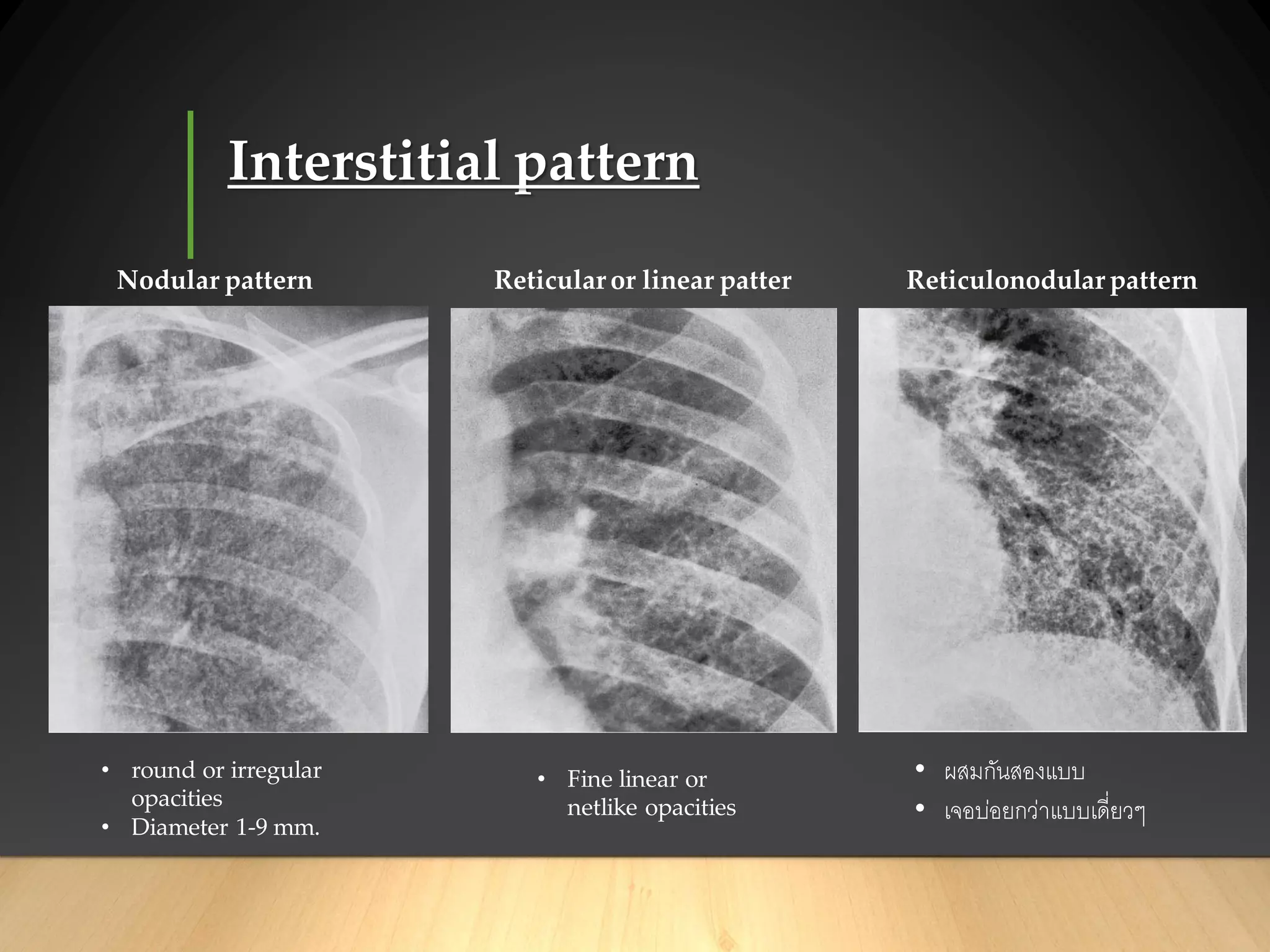 CXR and abdominal film interpretation for medical student | PDF