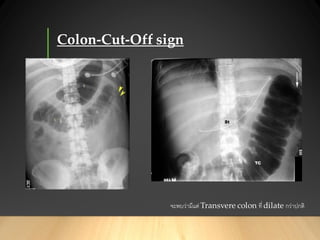 CXR and abdominal film interpretation for medical student | PDF