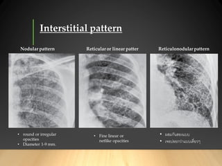CXR and abdominal film interpretation for medical student | PPT