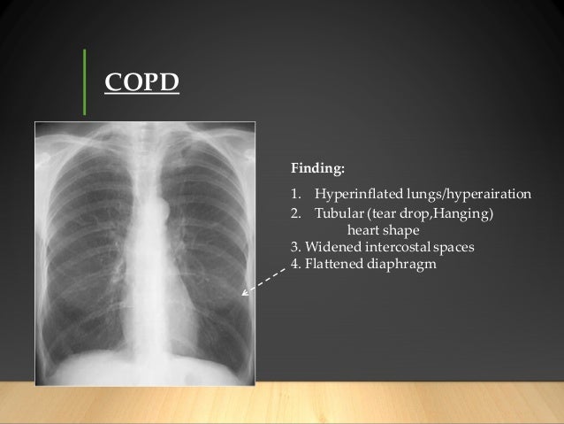 CXR and abdominal film interpretation for medical student