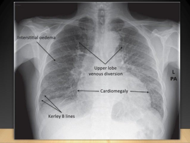 CXR and abdominal film interpretation for medical student