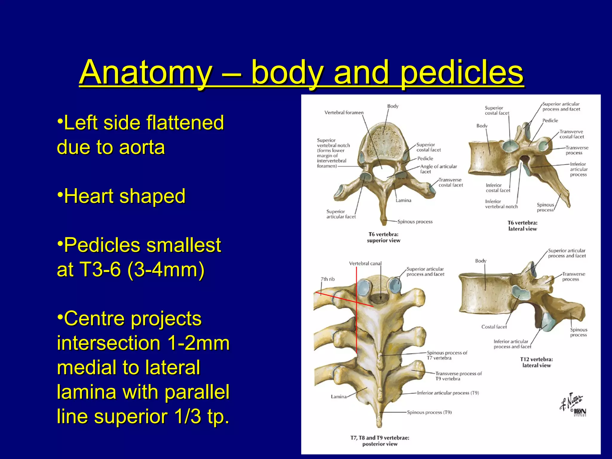 Clinical spinal anatomy for students v2 | PPT