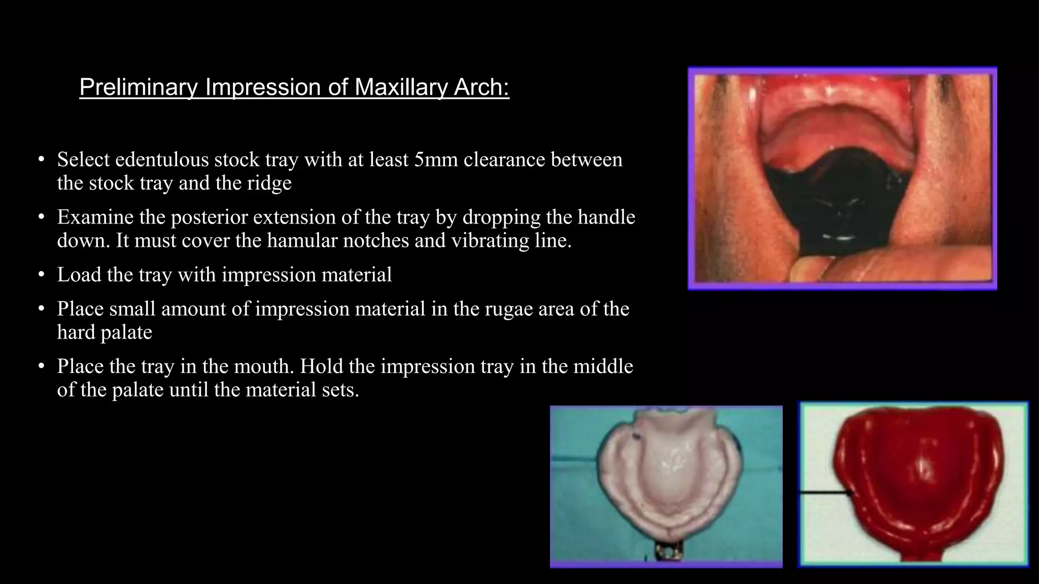 Clinical steps in fabricating a complete denture | PPTX