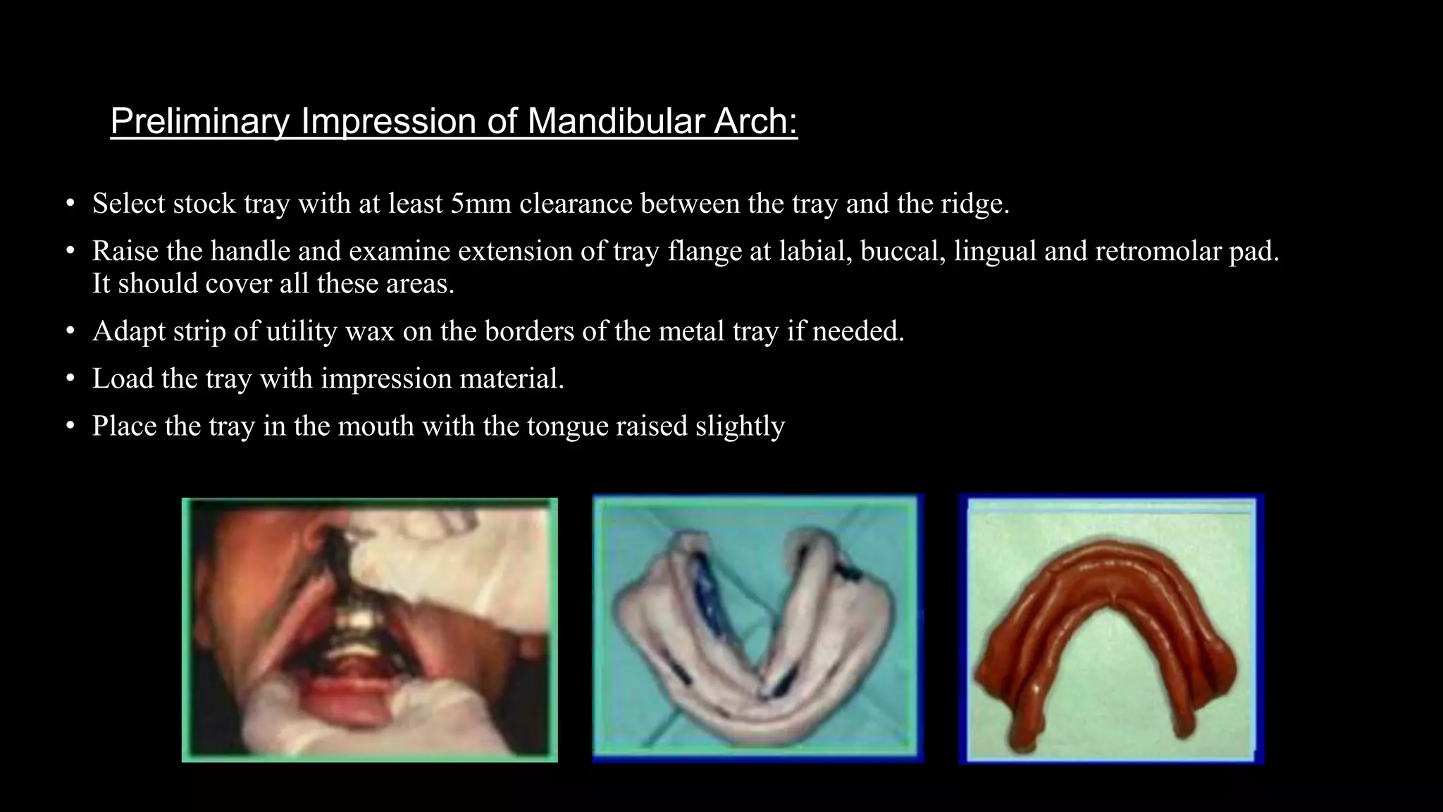 Clinical steps in fabricating a complete denture | PPTX
