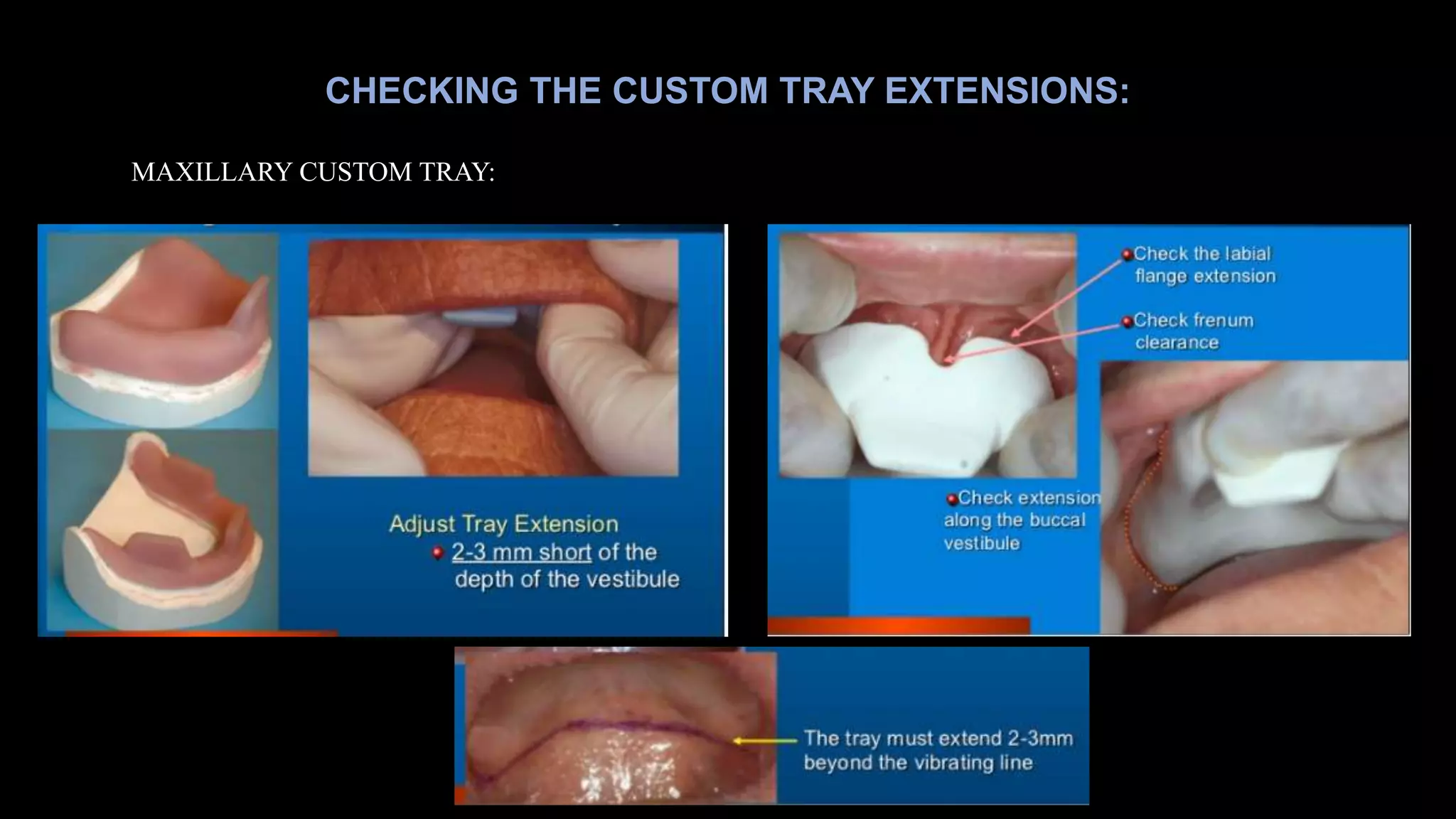 Clinical steps in fabricating a complete denture | PPTX