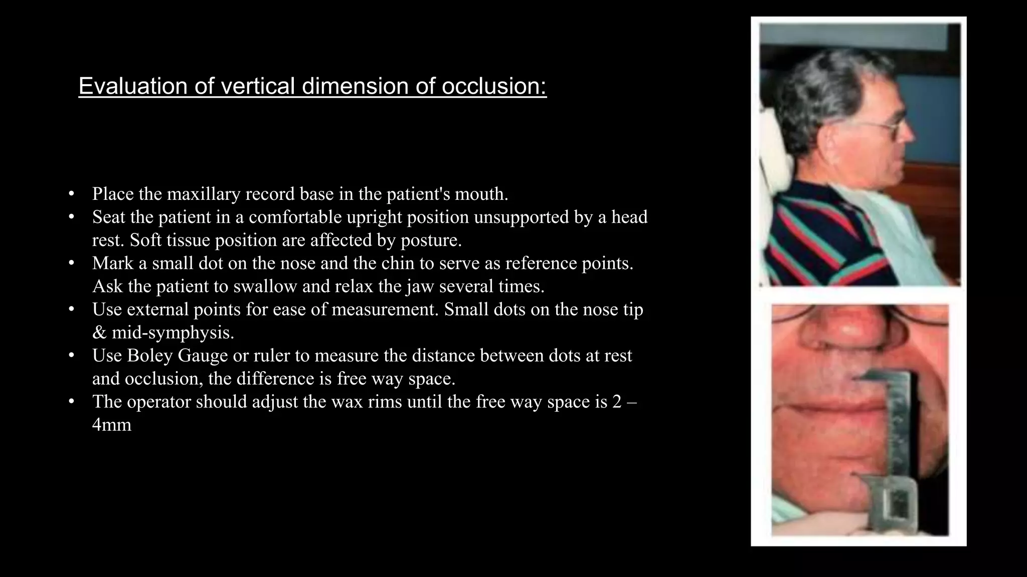 Clinical steps in fabricating a complete denture | PPTX