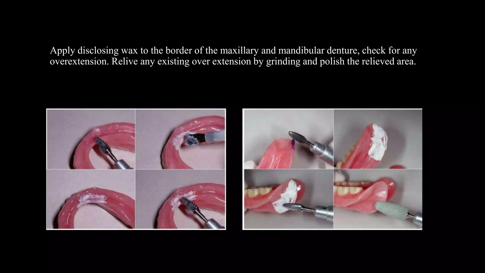 Clinical steps in fabricating a complete denture | PPTX