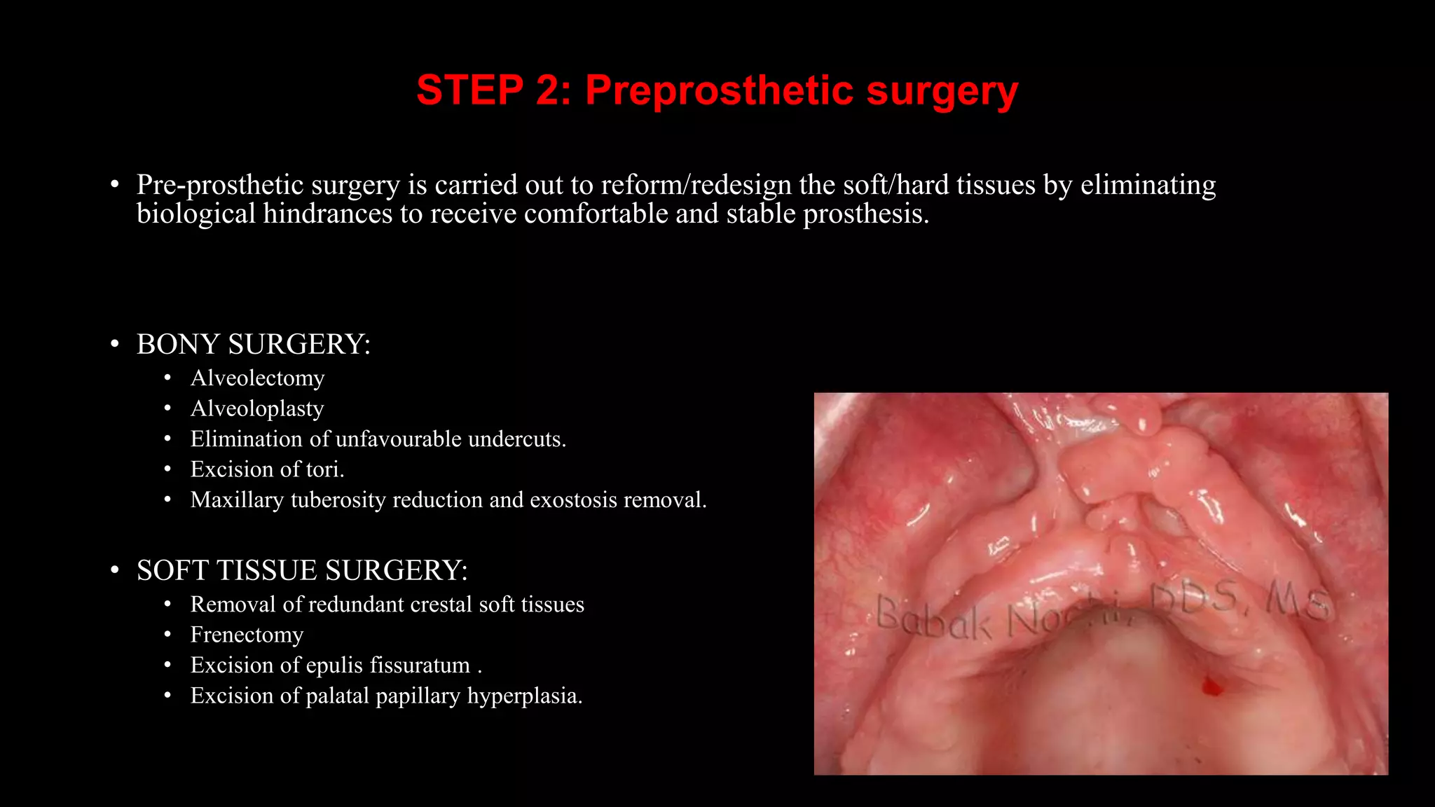 Clinical steps in fabricating a complete denture | PPTX