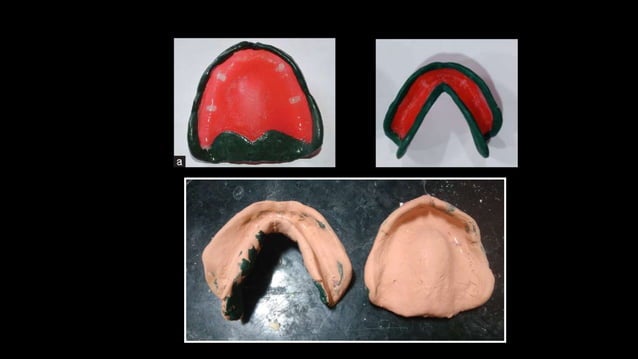 Clinical steps in fabricating a complete denture | PPTX