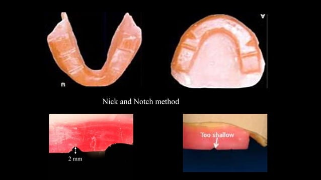 Clinical steps in fabricating a complete denture | PPTX