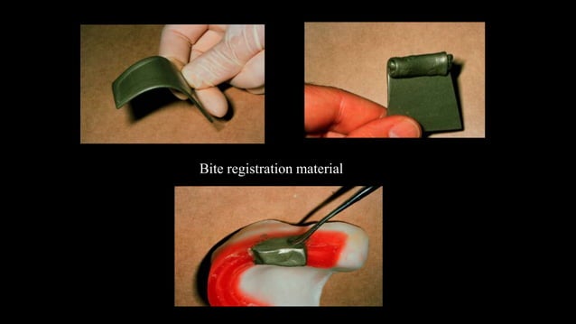 Clinical steps in fabricating a complete denture | PPTX