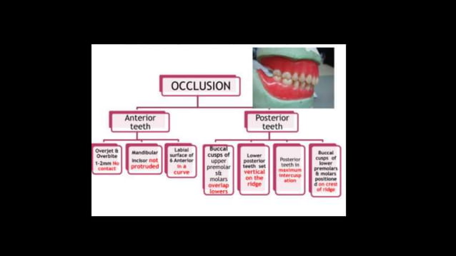 Clinical steps in fabricating a complete denture | PPTX