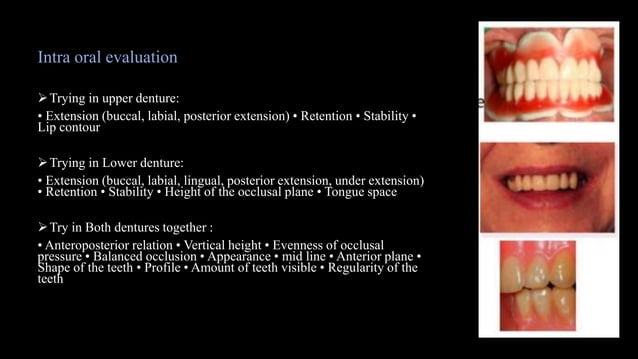 Clinical steps in fabricating a complete denture | PPTX