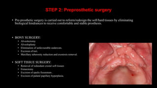 Clinical steps in fabricating a complete denture | PPTX