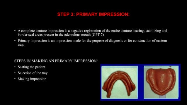 Clinical steps in fabricating a complete denture | PPTX