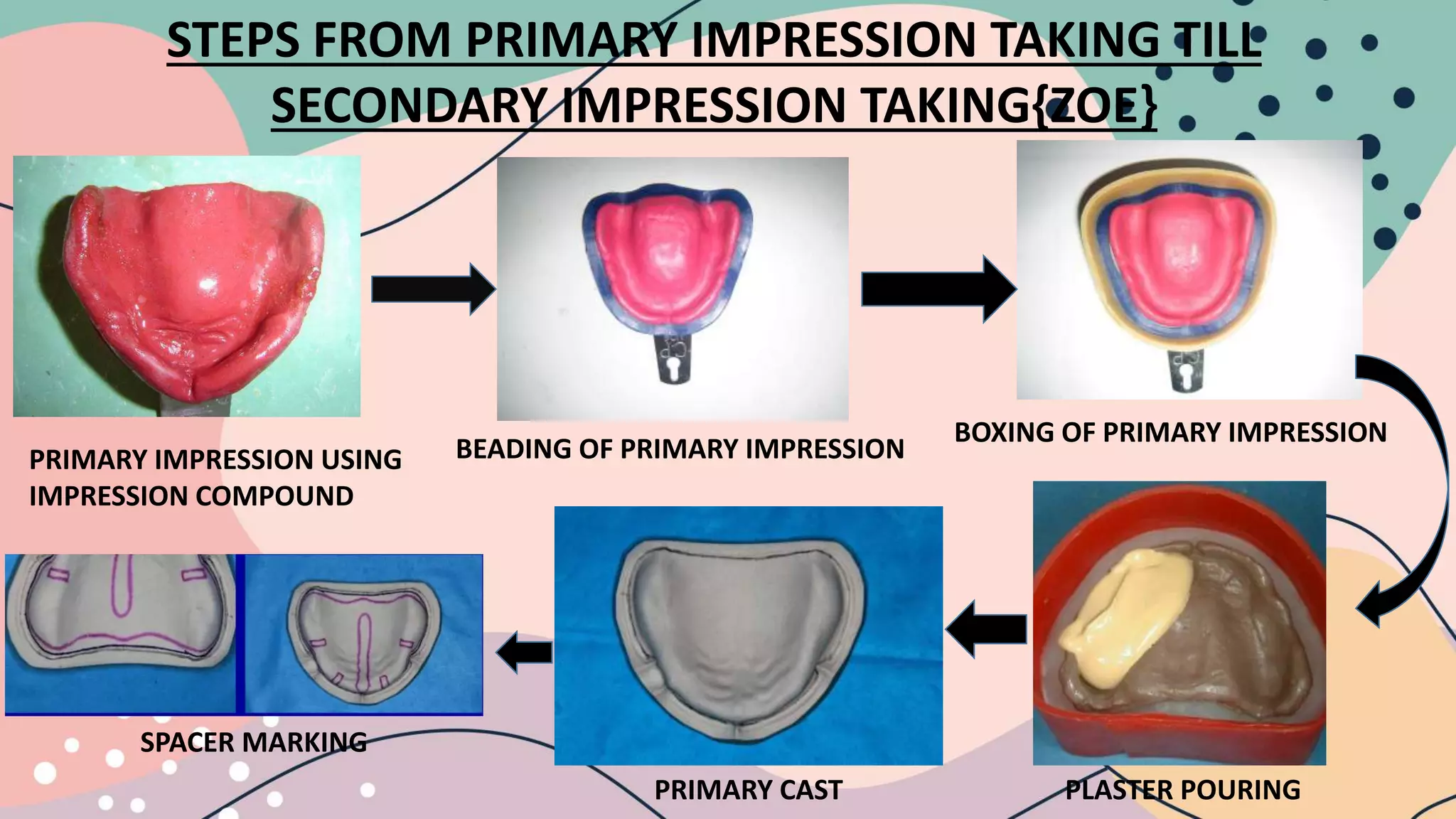 Clinical steps in impression making using ZOE {maxillary cast} | PPT